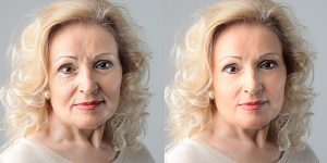 Managing Skin Changes During Menopause - Andromenopause